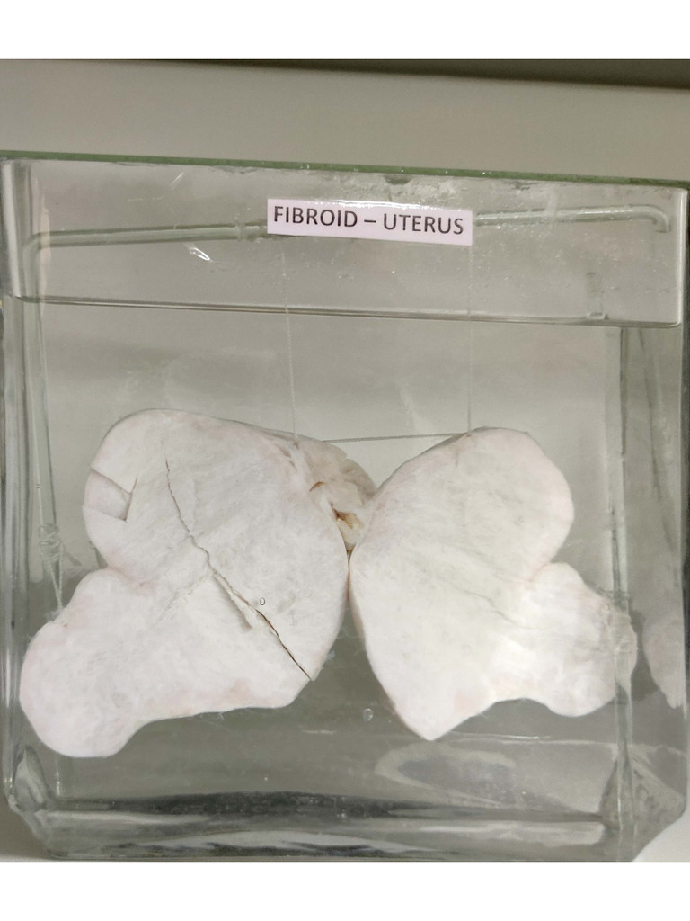 Pathology Specimen | PDF