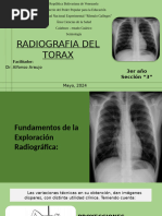 RX TORAX Como Se Lee | PDF | Tórax | Tórax (anatomía humana)