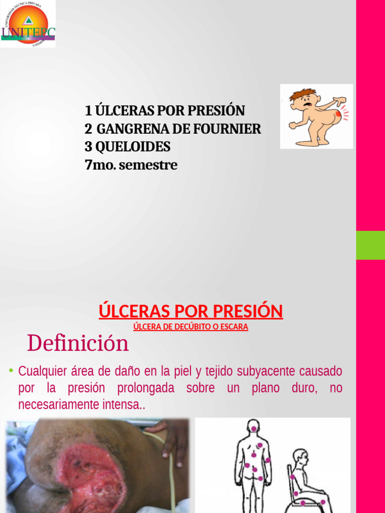 Úlceras por presión y gangrena de Fournier | PDF | Cicatrización de la ...