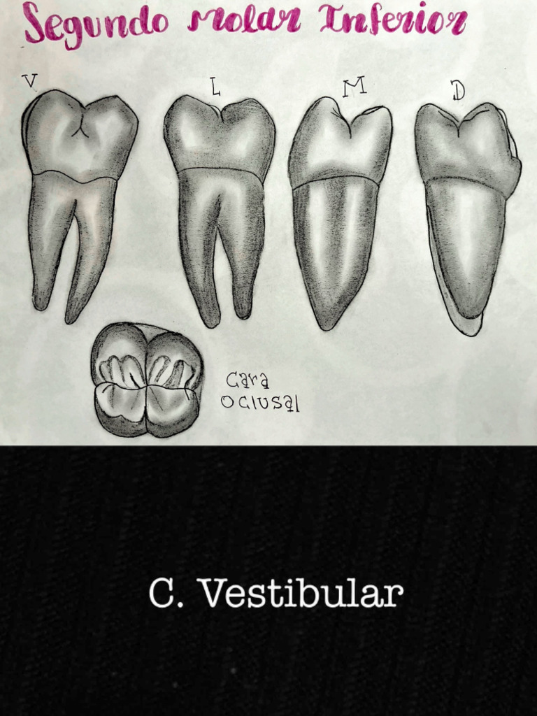 Segundo Molar Inferior | PDF