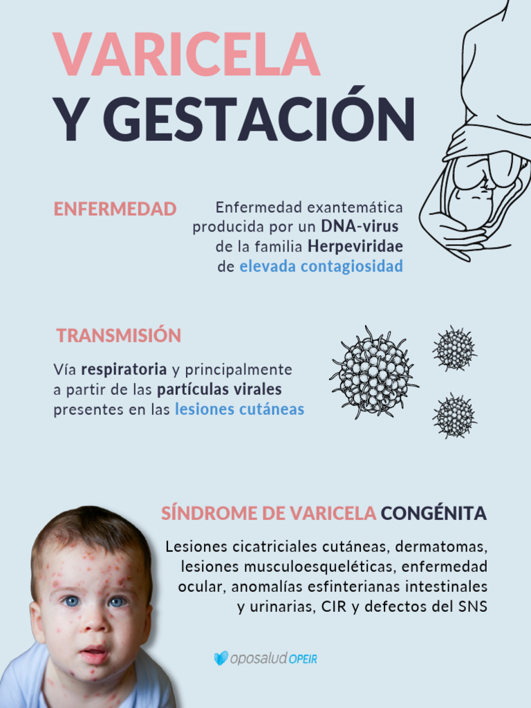_T22__INFOGRAF__A_SOBRE_VARICELA_Y_GESTACI__N | PDF