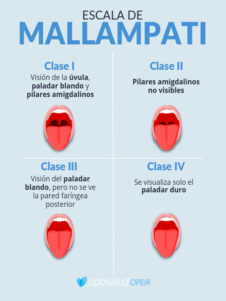 _T9__INFOGRAF__A_SOBRE_ESCALA__DE_MALLAMPATI_ | PDF