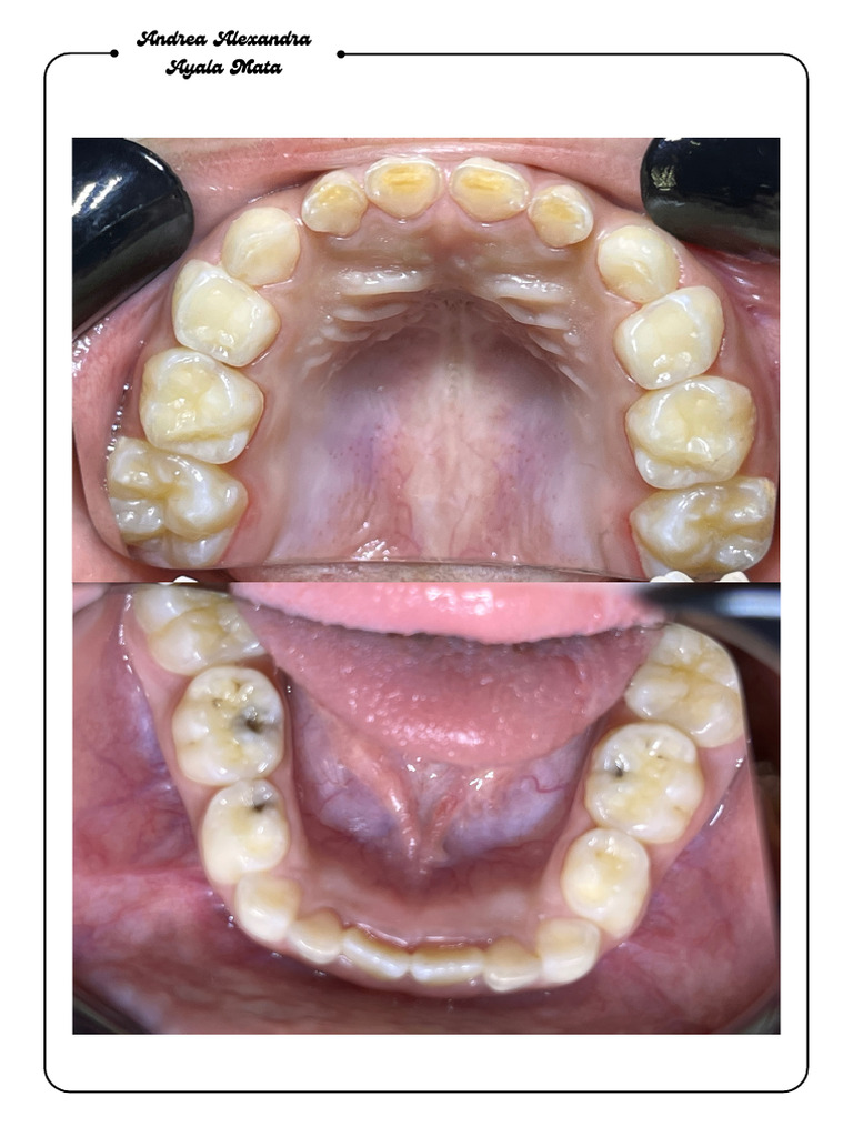 Andrea Alexandra Ayala Mata PDF | PDF