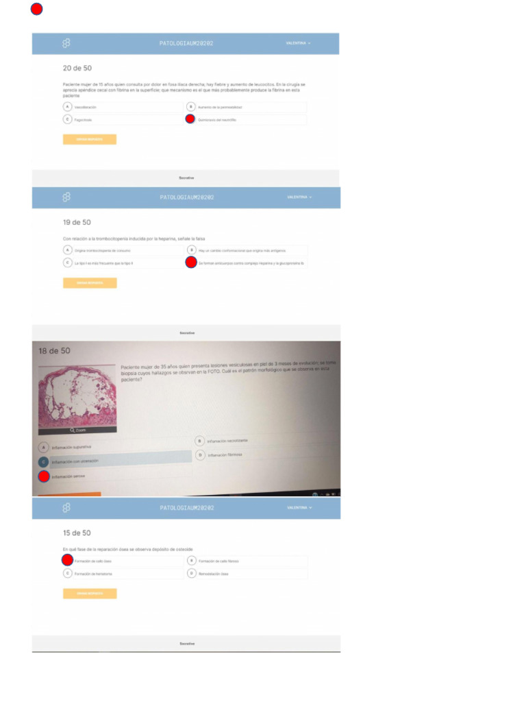 Fotos y Preguntas General 1 Corte (2) | PDF | Inflamación | Plaqueta