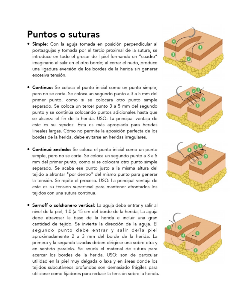 Puntos o Suturas. | PDF | Sutura Quirúrgica