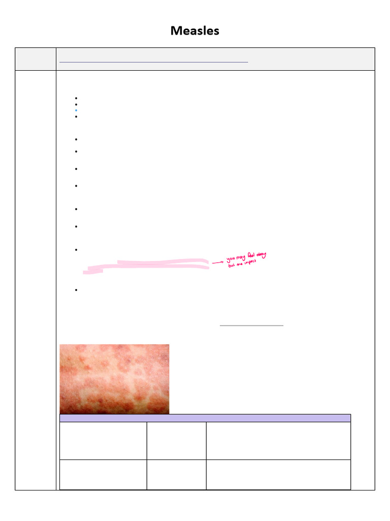 Measles Research Journal | PDF | Measles | Vaccination