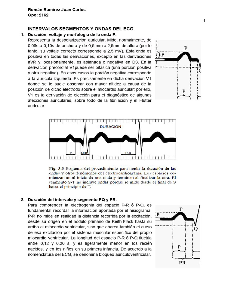 Análisis de Ondas y Segmentos del ECG | PDF | Medicina Interna ...