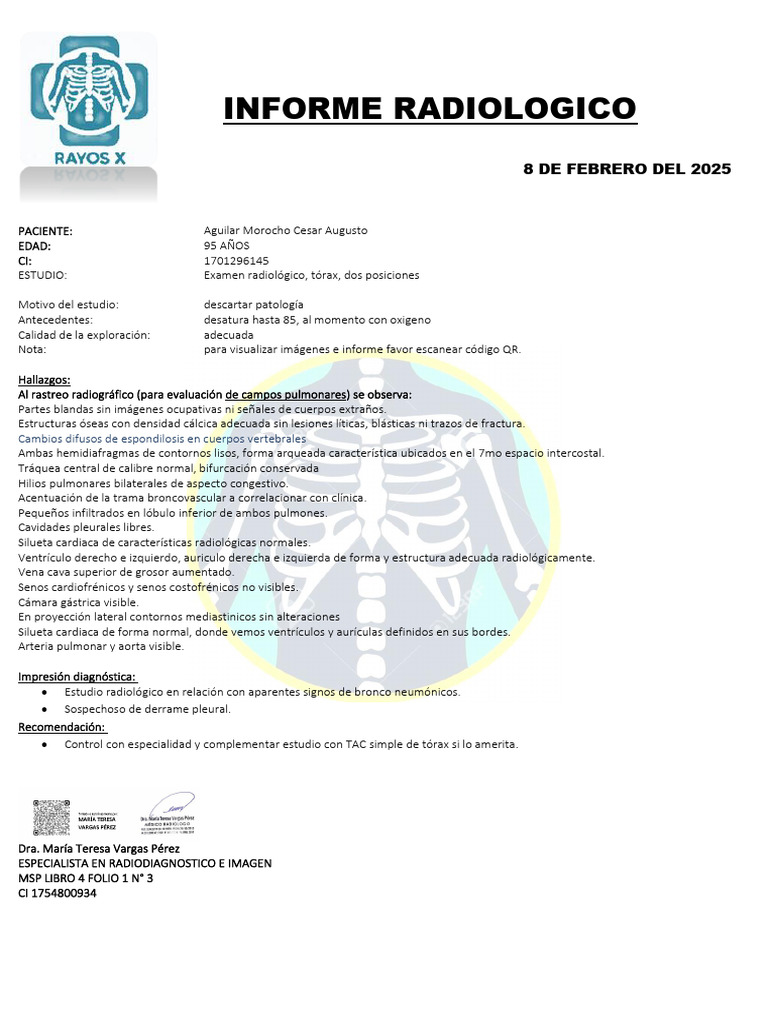 Aguilar Morocho Cesar Augusto | PDF