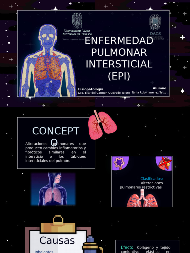 EPI(Enfermedad Pulmonar Intersticial | PDF | Medicina CLINICA | Enfermedades y trastornos humanos