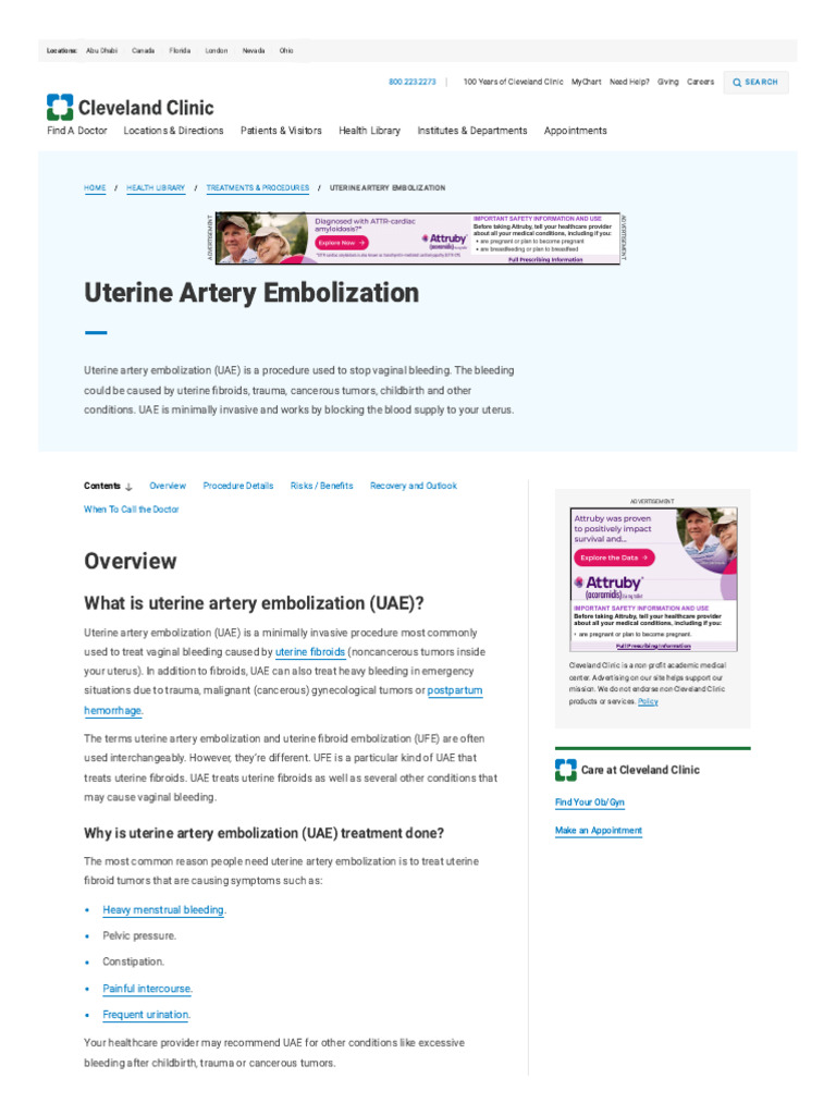 Uterine Artery Embolization Overview | PDF | Uterus | Pregnancy