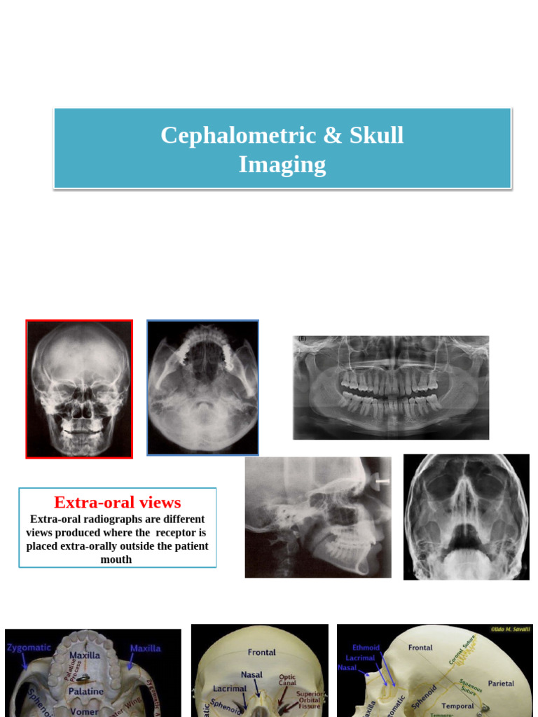 Cephalometric & Extra-Oral Imaging Guide | PDF | Skull | Human Head And ...