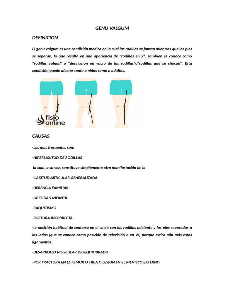 Genu Valgum: Causas y Tratamientos | PDF | Rodilla | Especialidades Medicas