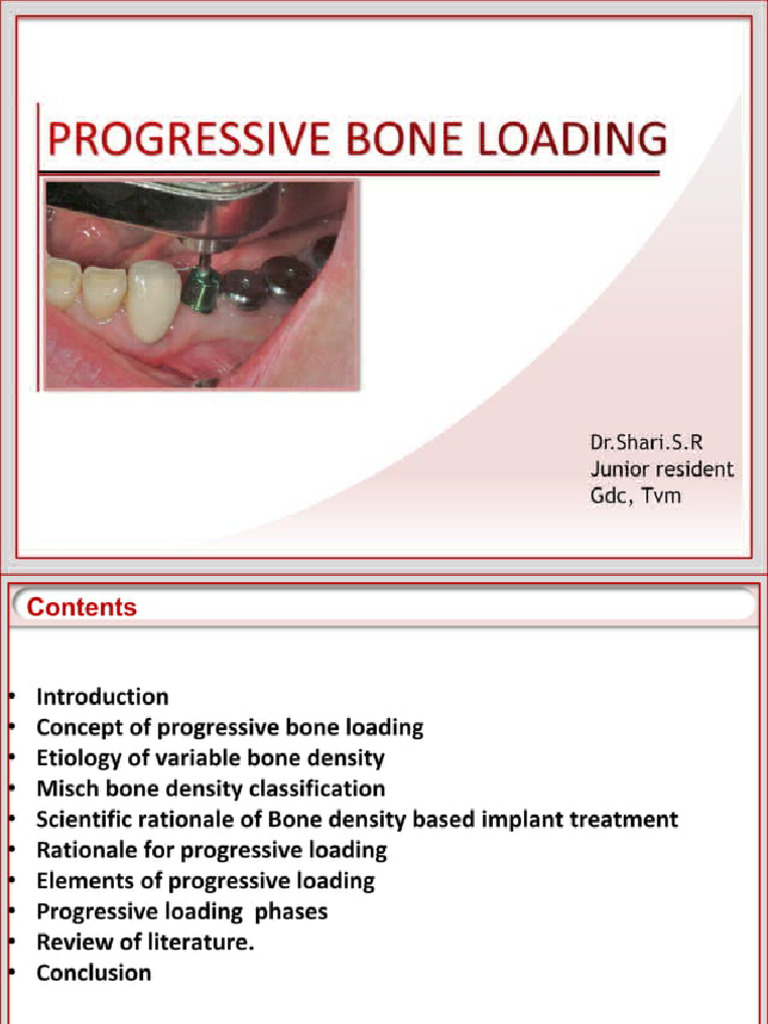 Progressive Loading in Implants 250142993 | PDF