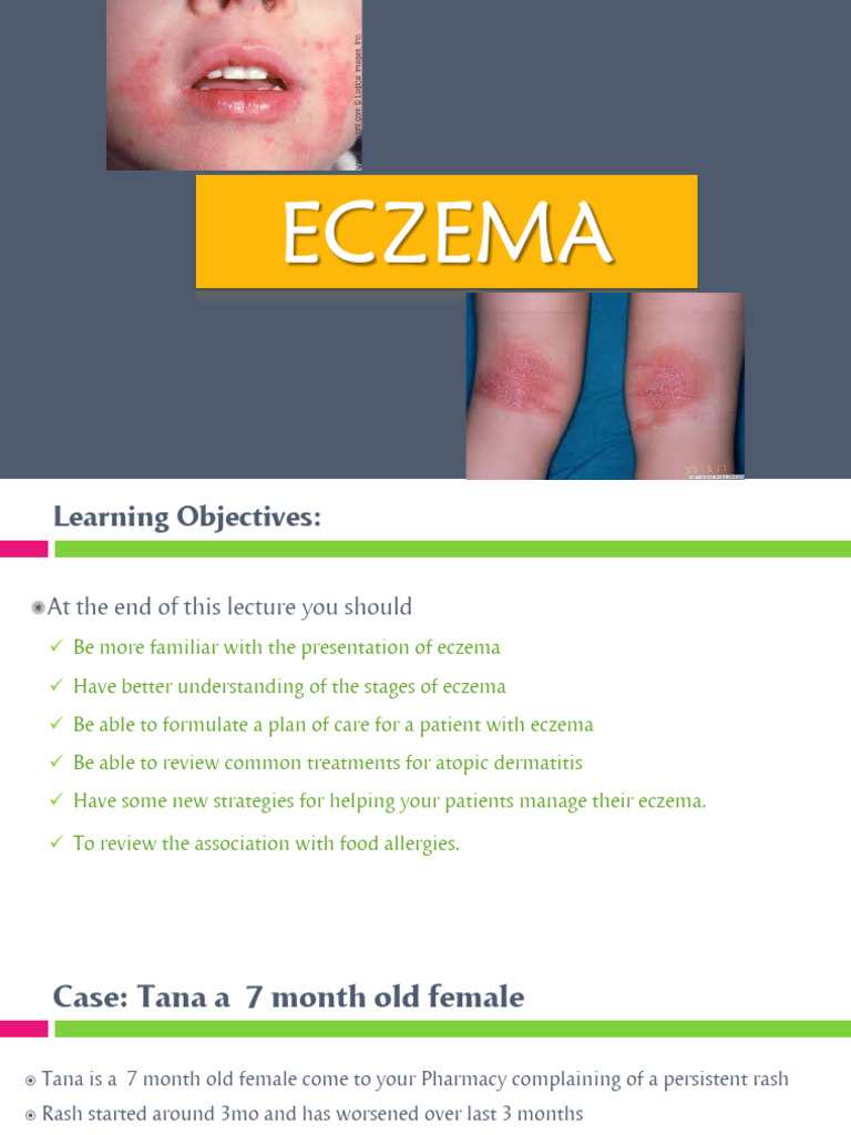 PD101 L7 Eczema | PDF | Dermatitis | Topical Medication