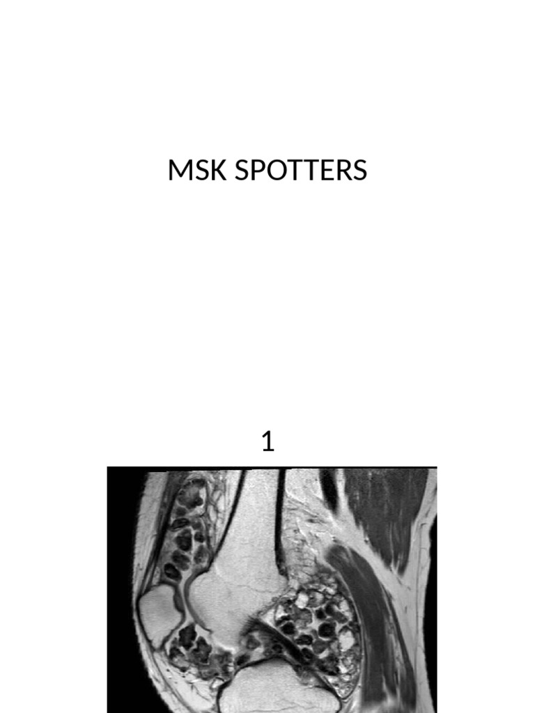 MSK Spotters | PDF