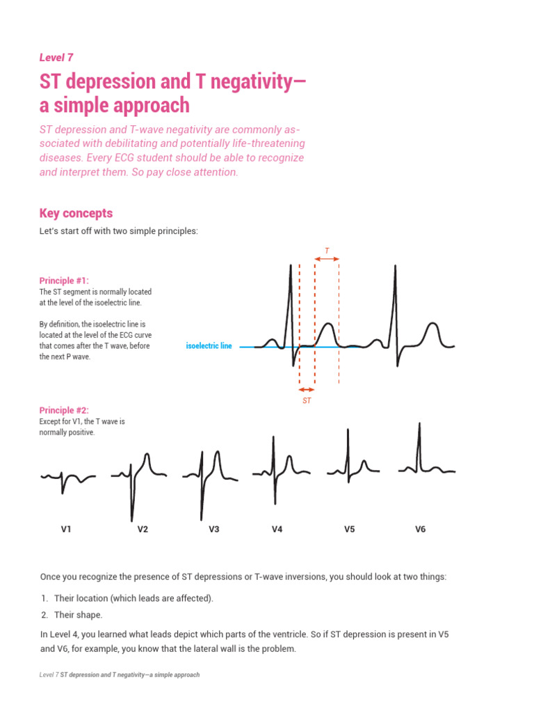 ST Depression and T Wave Inversion Guide | PDF | Cardiac ...