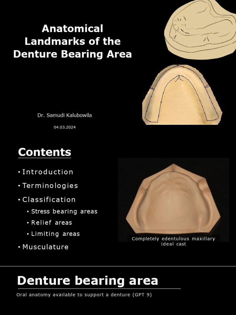 Anatomical Landmarks in Denture Design | PDF | Dentures | Anatomical ...