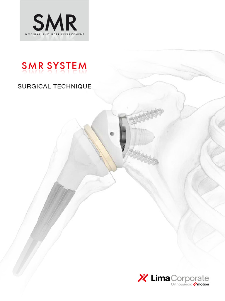 SMR Shoulder System Surgical Techniques | PDF | Surgery | Shoulder