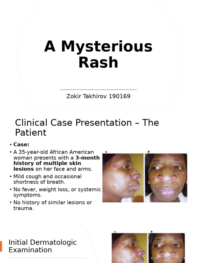 Mysterious rash | PDF | Diseases And Disorders | Medical Specialties