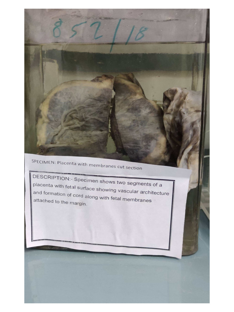 Surgery specimen | PDF