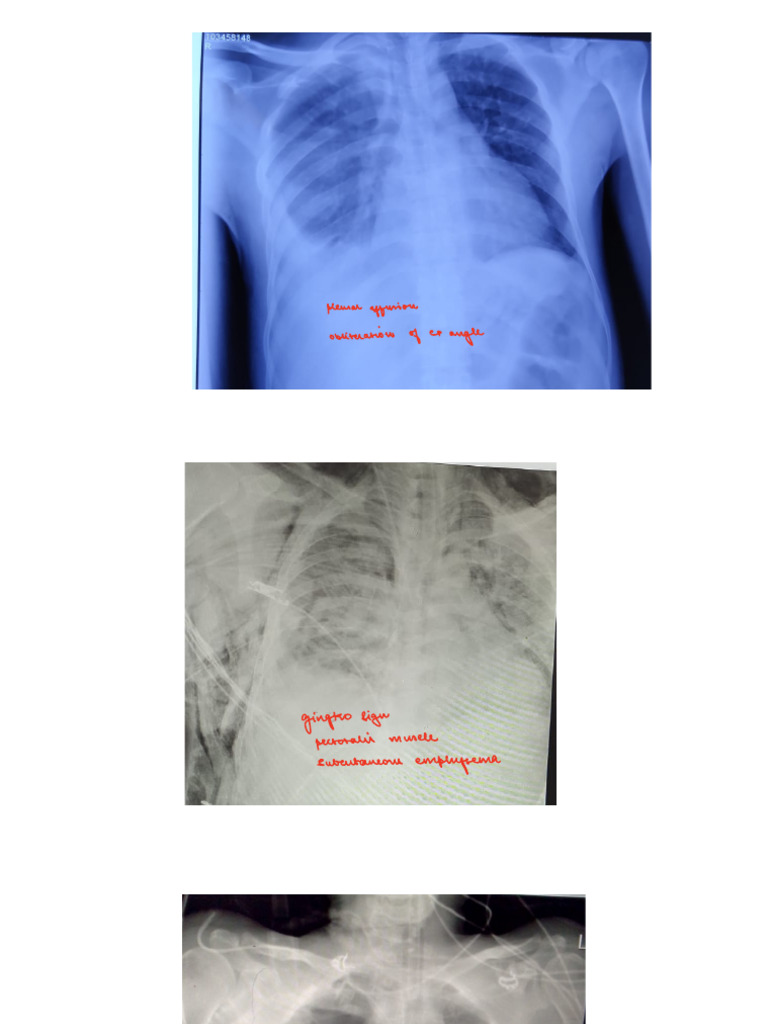 Surgery Xrays and Instruments | PDF