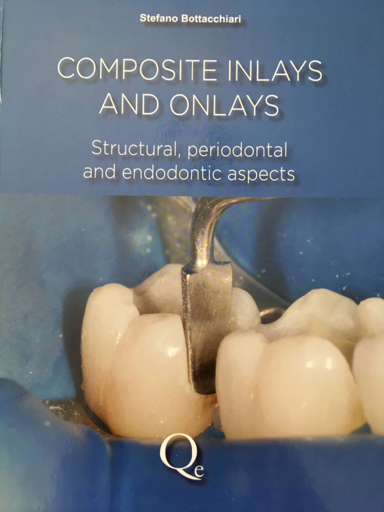 00 Composite Inlays and Onlays 2 | PDF