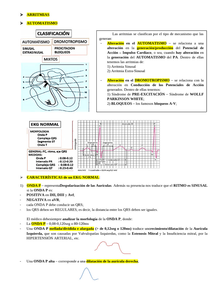 Características y Mecanismos del EKG | PDF | Arritmia cardiaca ...