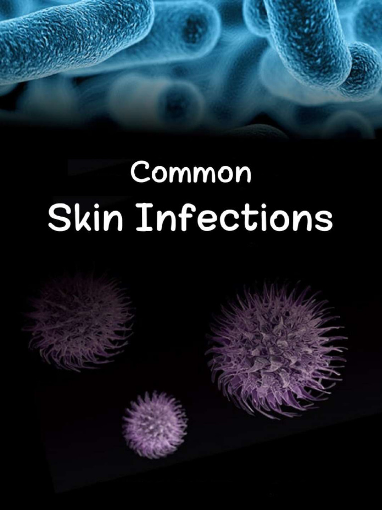 Common Skin Infections | PDF | Candidiasis | Cutaneous Conditions