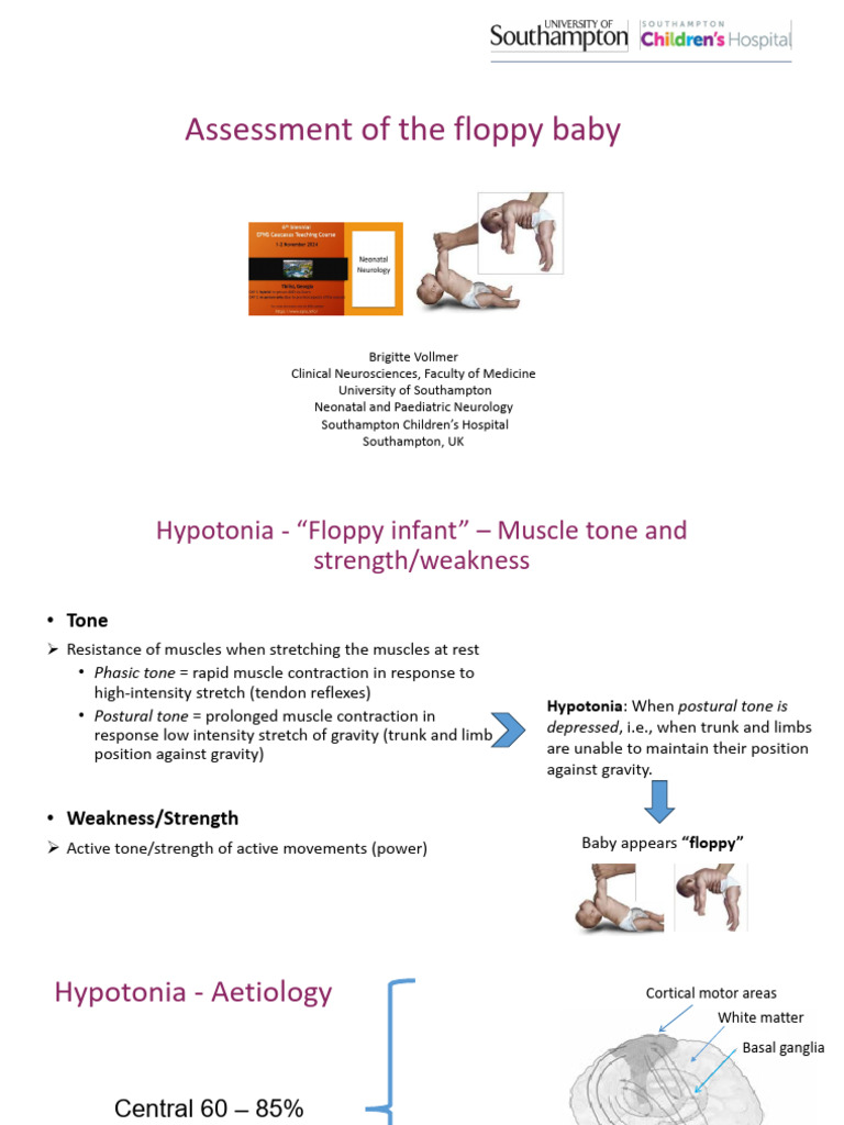 Assessment of the floppy baby_EPNS Nov 2024_BV | PDF | Neurological ...