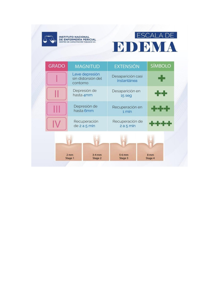 Edema | PDF