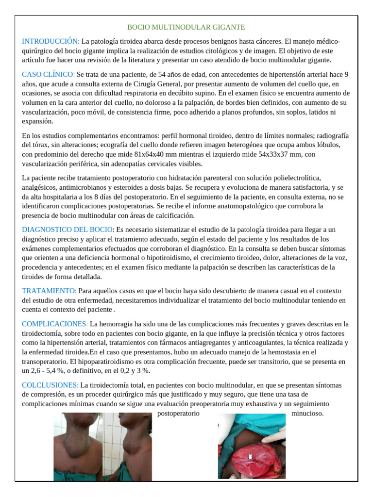 Manejo del Bocio Multinodular Gigante | PDF | Hipotiroidismo ...