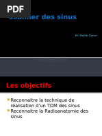 Scanographie des Sinus : Guide Complet | PDF | Anatomie humaine | Otorhinolaryngologie