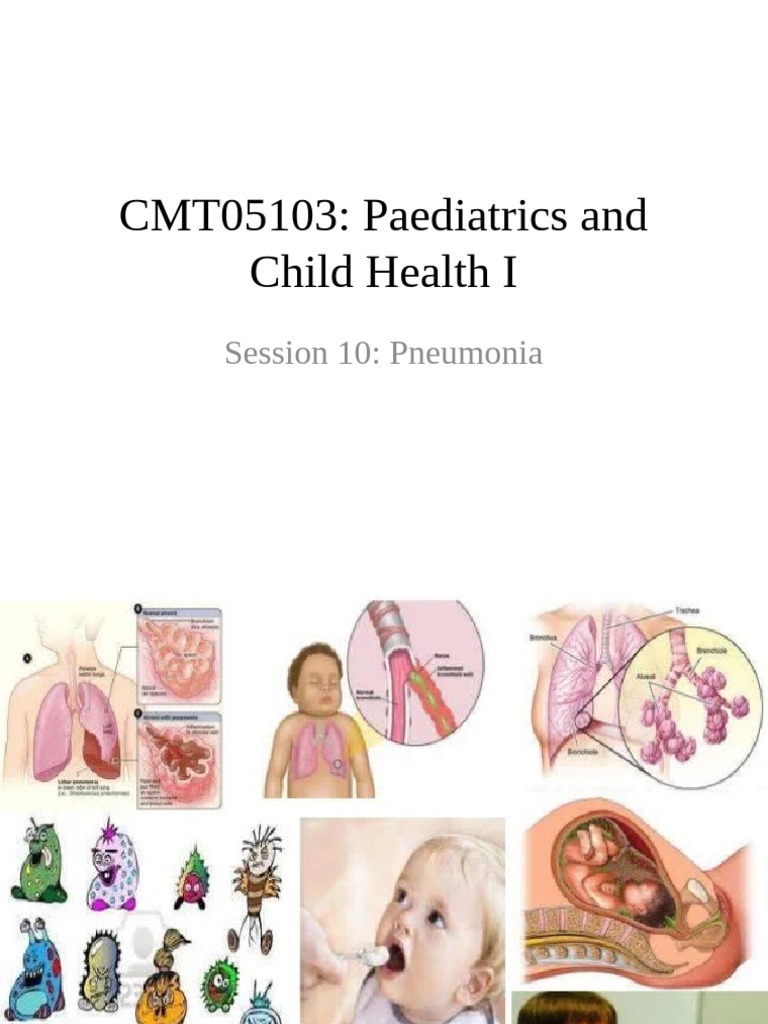 Session 10 Pneumonia 1 | PDF | Pneumonia | Lung