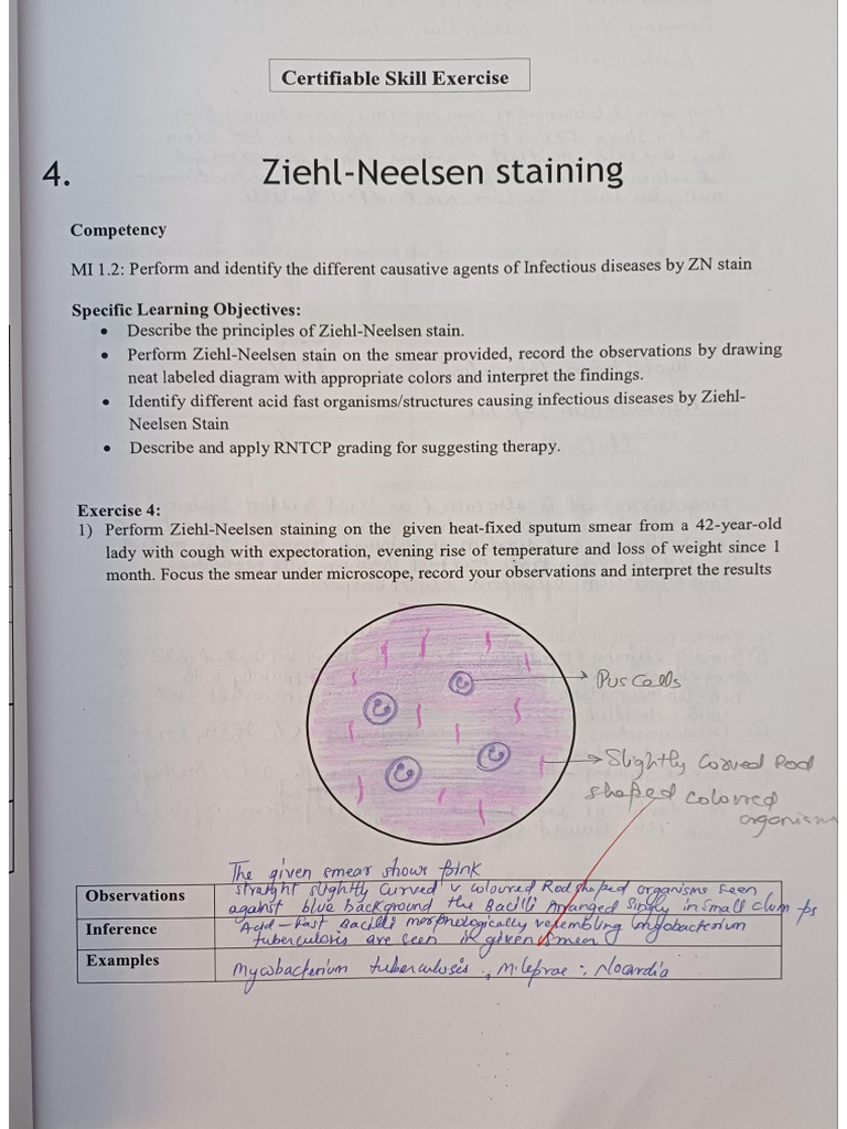 ZN Staining | PDF
