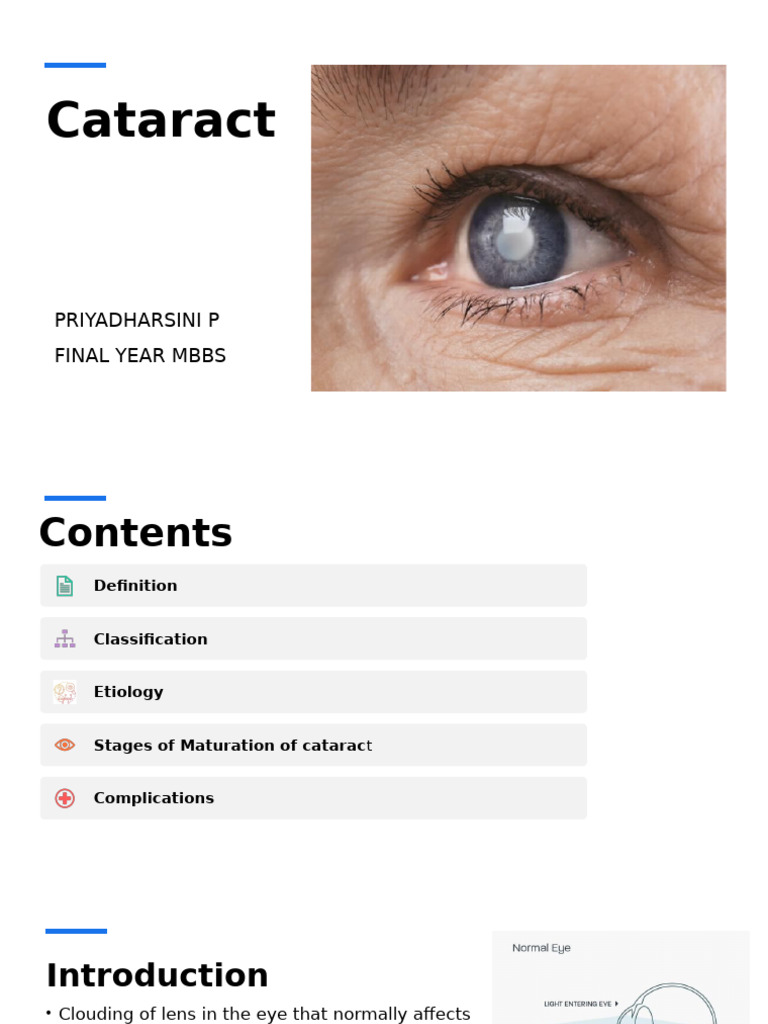 Comprehensive Guide to Cataracts | PDF | Cataract | Vision