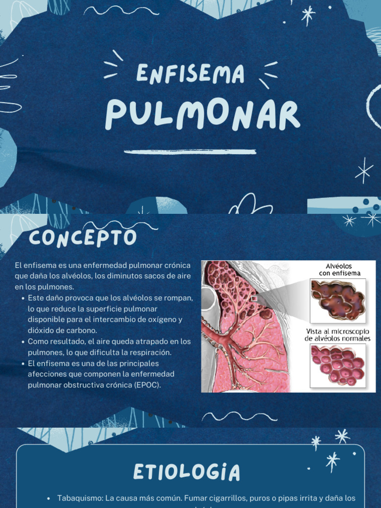 Enfisema Pulmonar: Causas y Tratamientos | PDF | Pulmón | Enfermedad ...