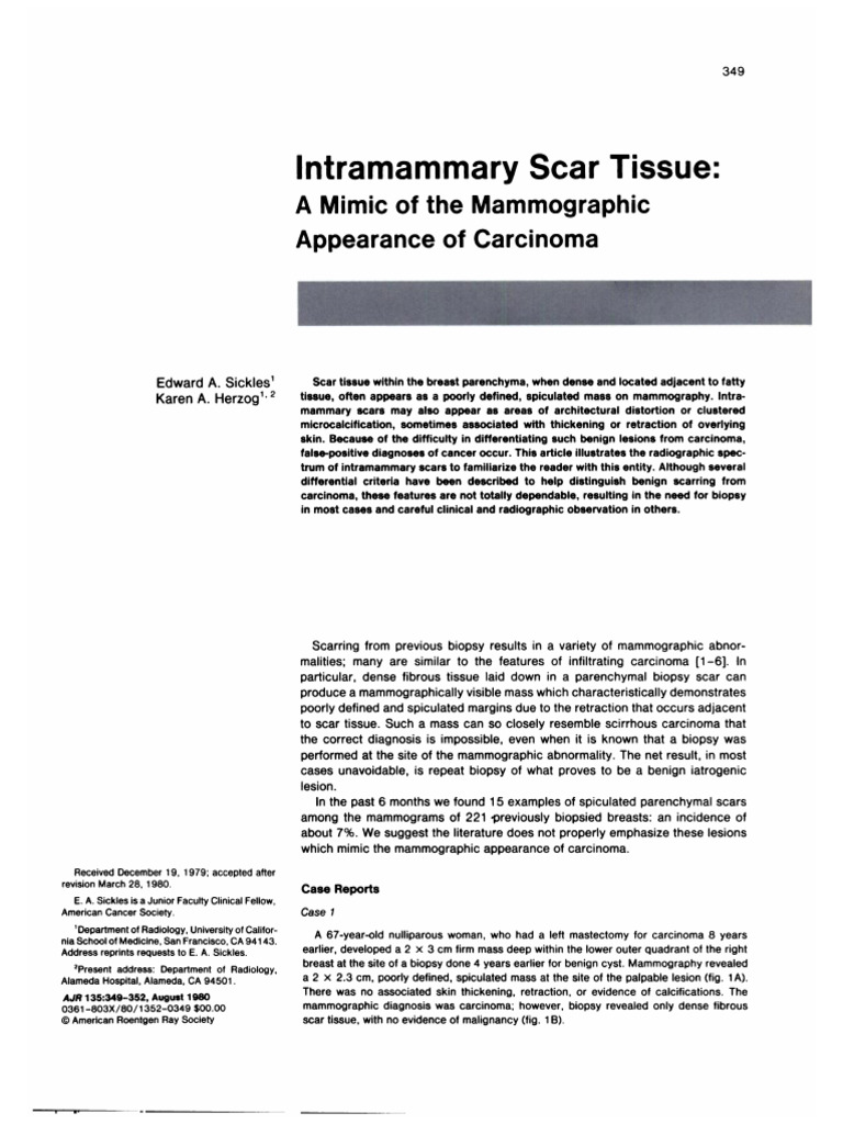 Sickles Herzog 2012 Intramammary Scar Tissue A Mimic of The ...