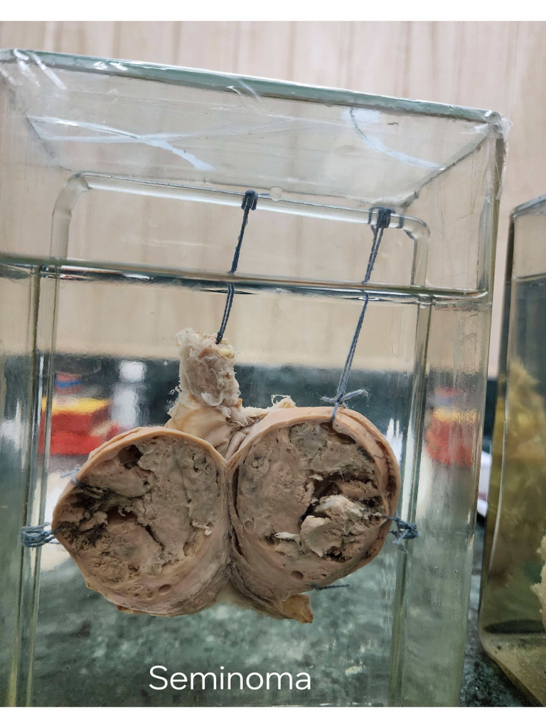 Pathology Specimens | PDF