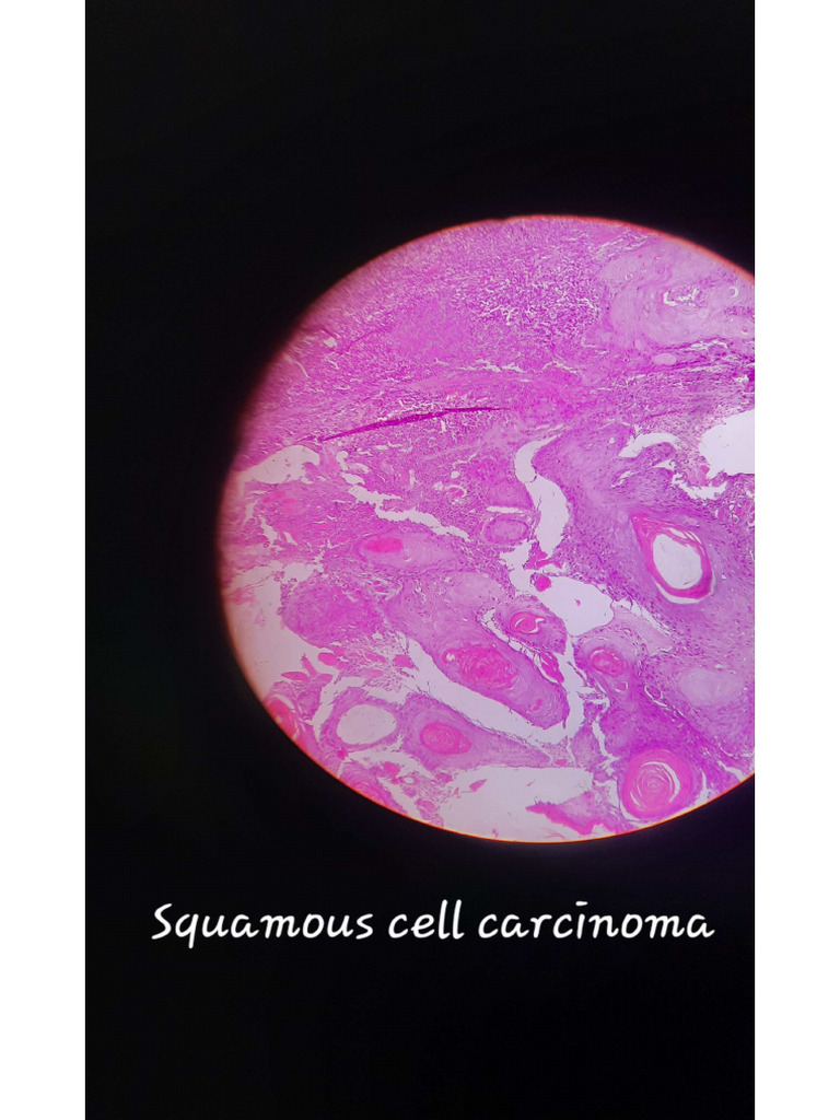 Pathology Slides and Specimens | PDF