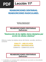 Rizolisis Dental 2 | PDF | Hueso | Inflamación