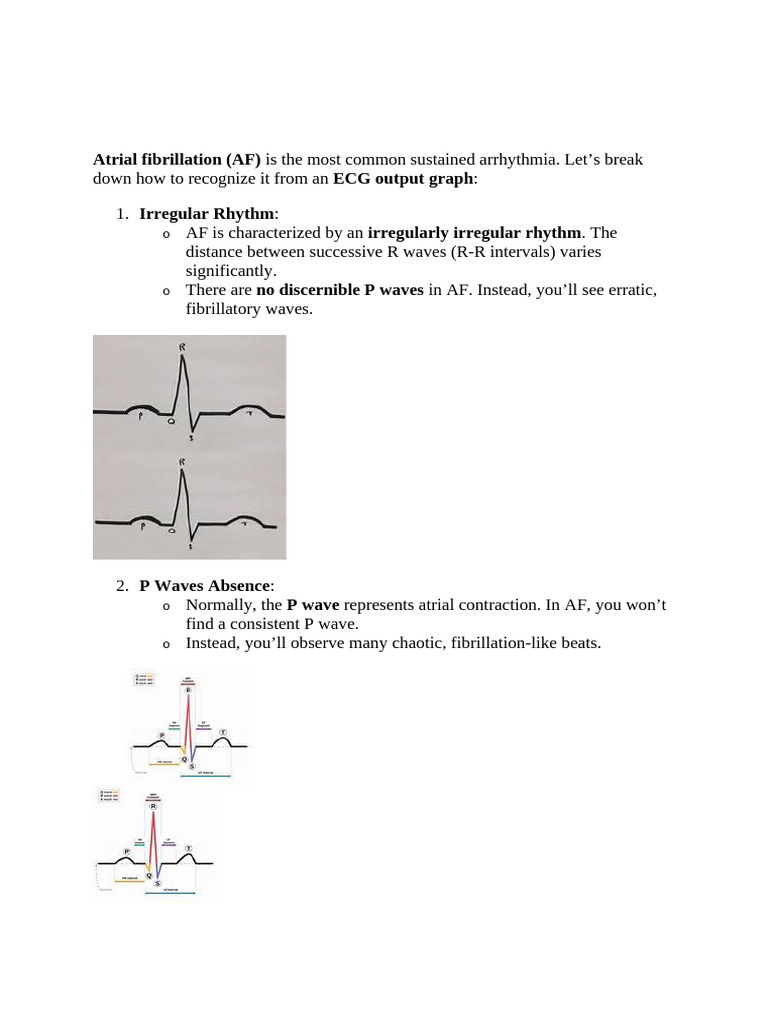 Recognizing Atrial Fibrillation on ECG | PDF | Heart Rate ...