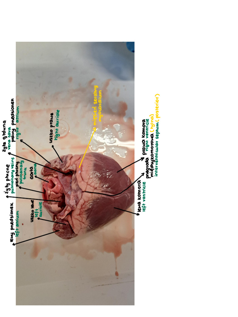 Anatomia Serca Szpilki | PDF