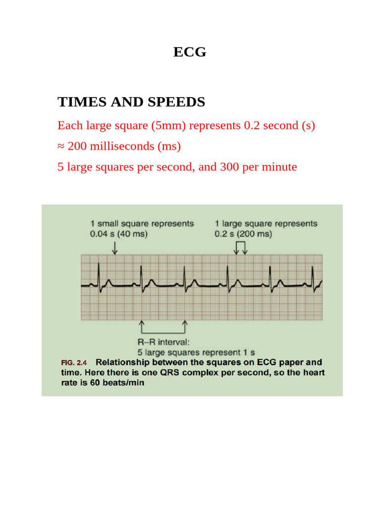 Each Large Square (5mm) Represents 0.2 Second (S) 200 Milliseconds (MS ...