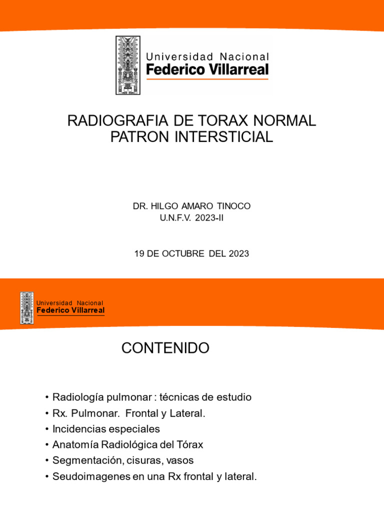 Radiografía de Tórax Normal - Patrón Intersticial | PDF | Pulmón | Tórax
