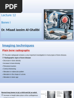 Lodwick Classification for Bone Tumor Growth | PDF | Medical Imaging ...