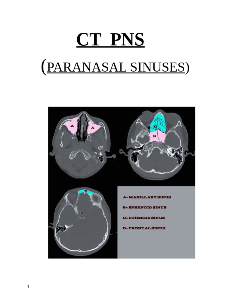 CT PNS 1 | PDF | Human Nose | Ct Scan