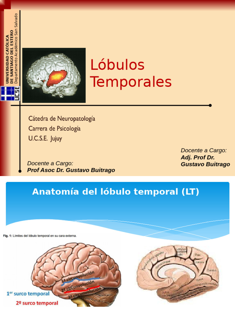Anatomía y Funciones del Lóbulo Temporal | PDF | Las emociones | Lóbulo ...