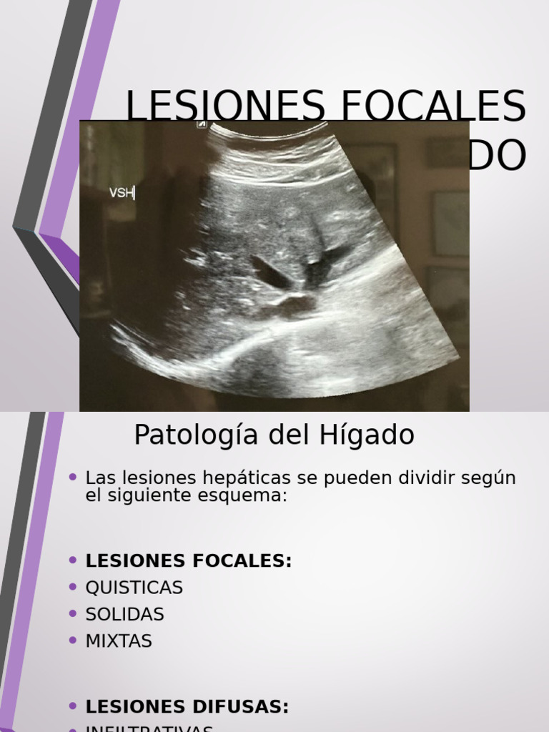 Lesiones Hepaticas y Difusas | PDF | Hígado | Medicina CLINICA