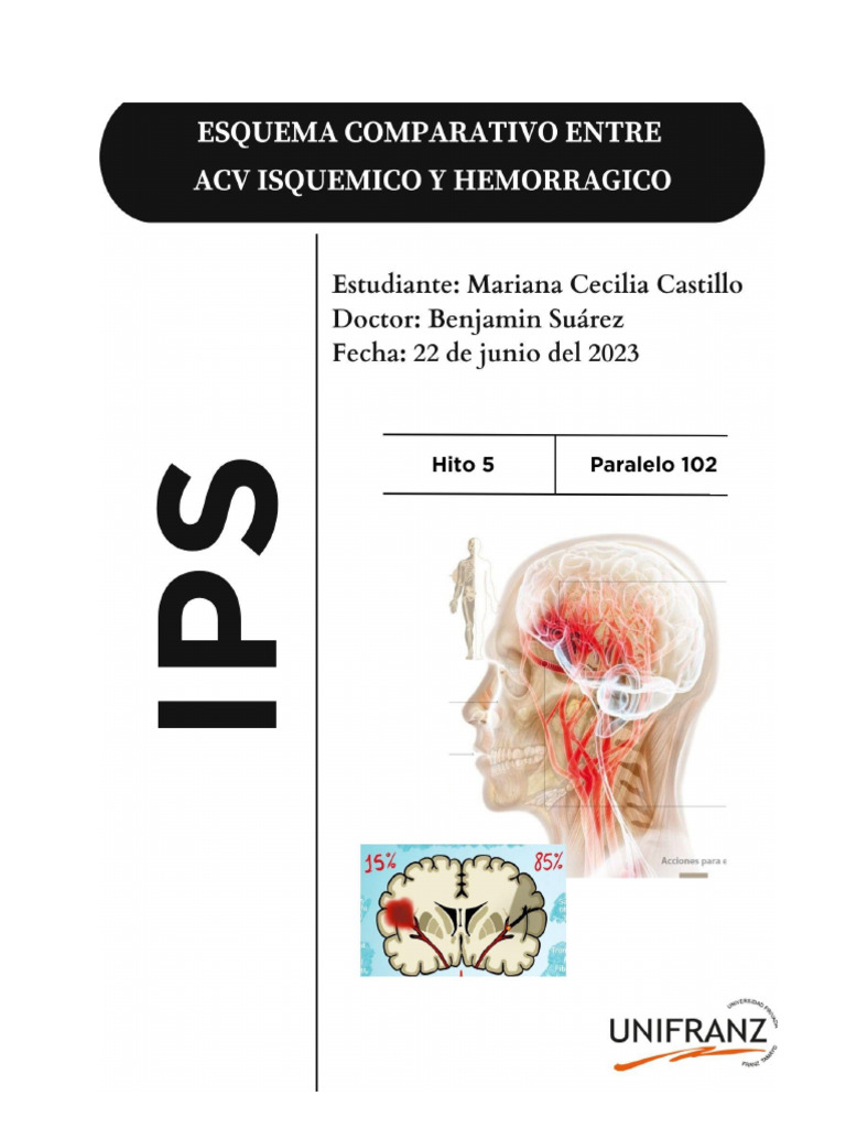 Diferencias Del Acv | PDF