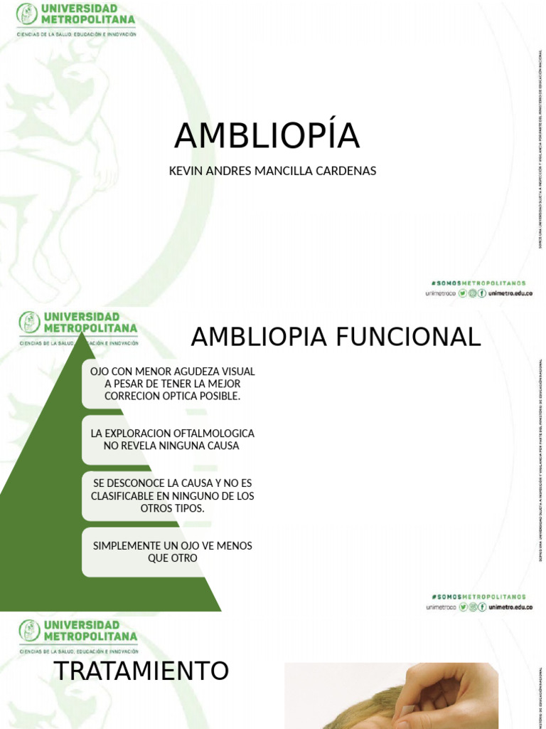 Amblipía: Tipos y Tratamientos Efectivos | PDF | Ligero | Sentidos